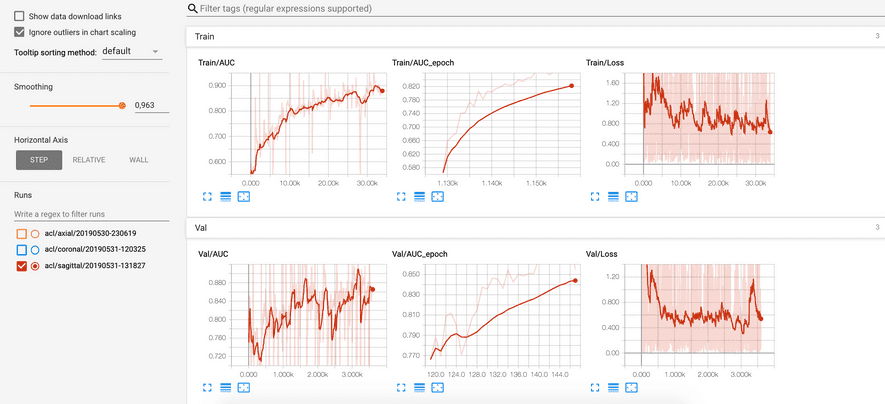 Automate the diagnosis of Knee Injuries 🏥 with Deep Learning part 2 ...