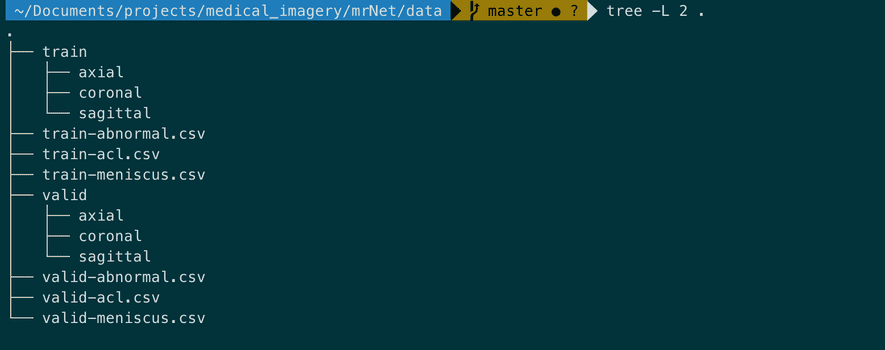 Automate the diagnosis of Knee Injuries 🏥 with Deep Learning part 1: an ...
